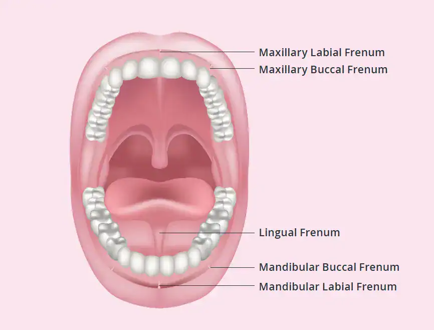 Frenectomie laser la copii – Fără bisturiu, fără durere - Innovation ...
